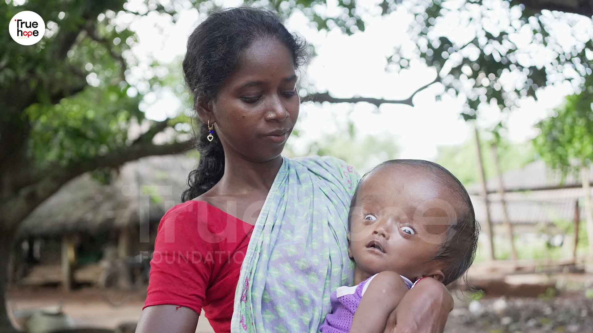 We’ve Already Lost A Child Before, We Can’t Lose Her Too! Please Help ...